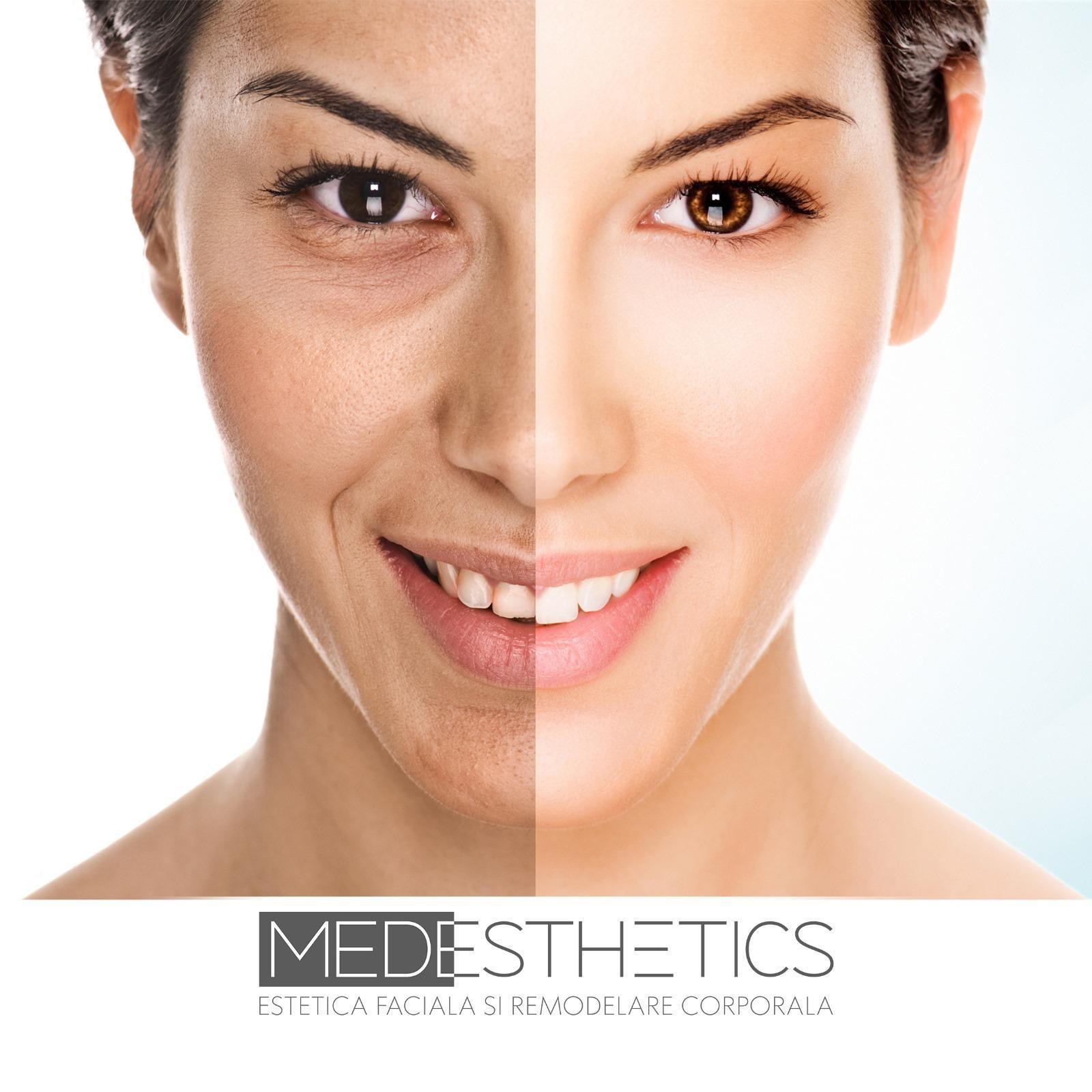 Peeling depigmenting - MEDESTHETICS